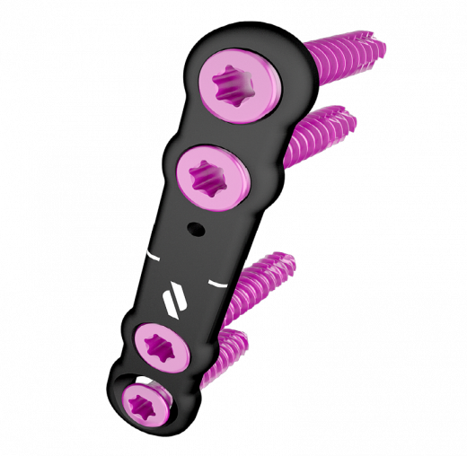 Lapidus Plates | Novastep