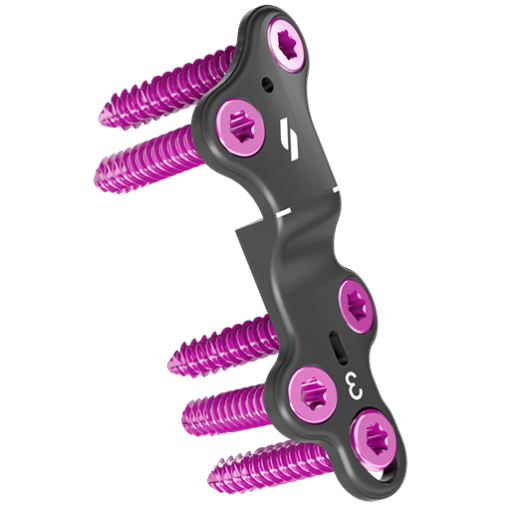 MTP Fusion Plates | Novastep