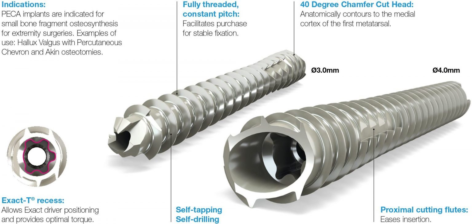 MIS Bunion Correction | Novastep