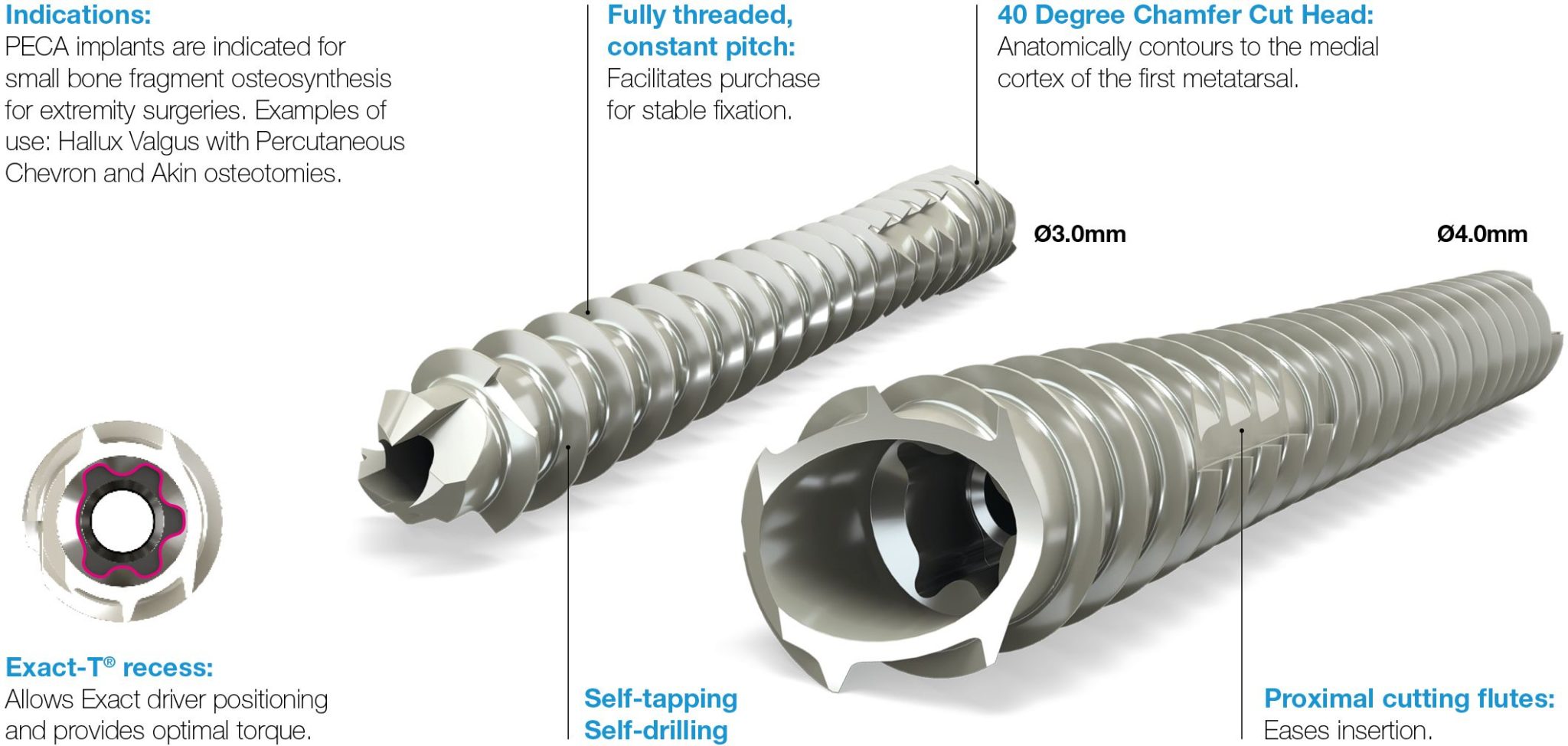 MIS Bunion Correction | Novastep