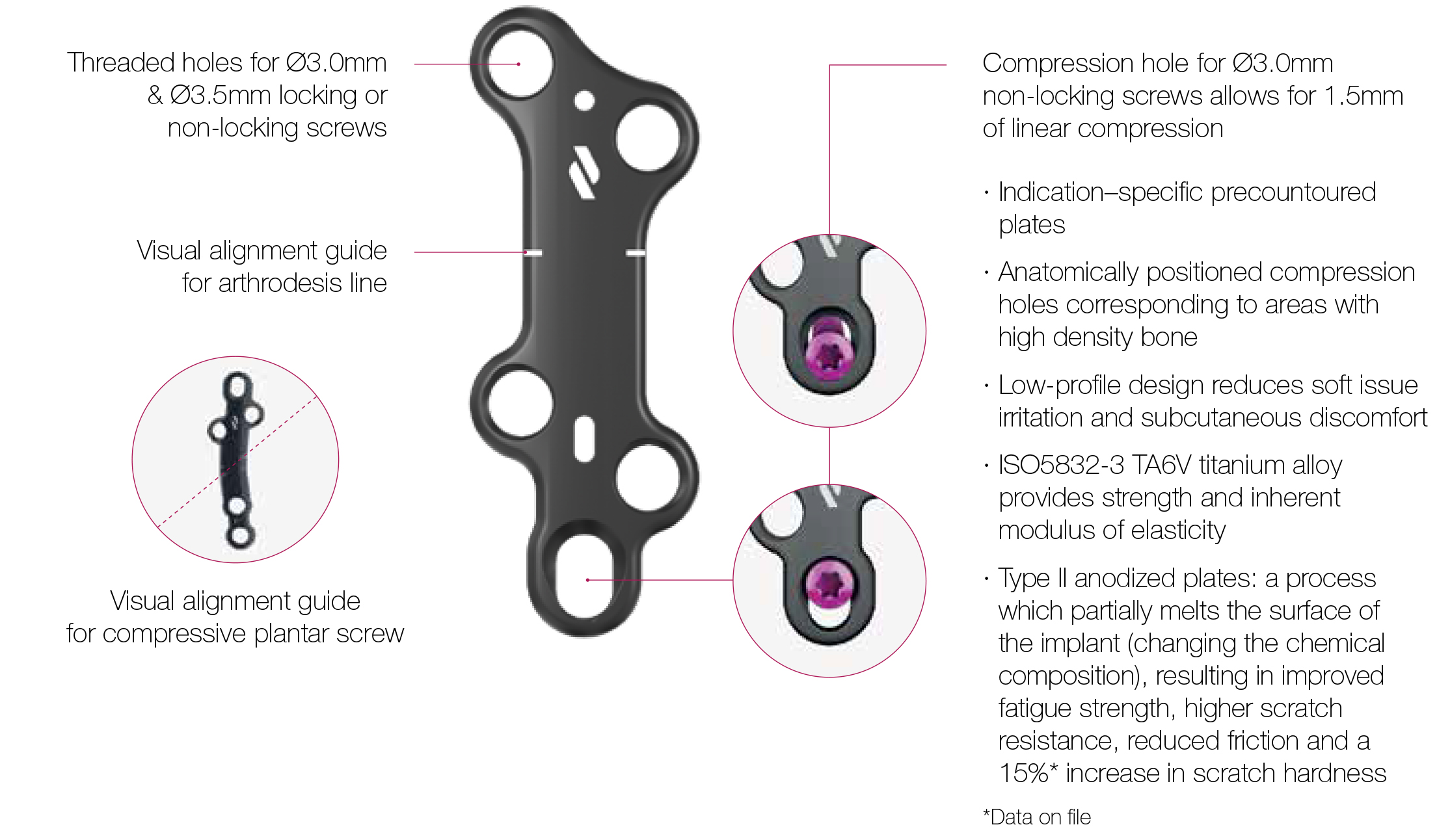 MTP Fusion Plates | Novastep