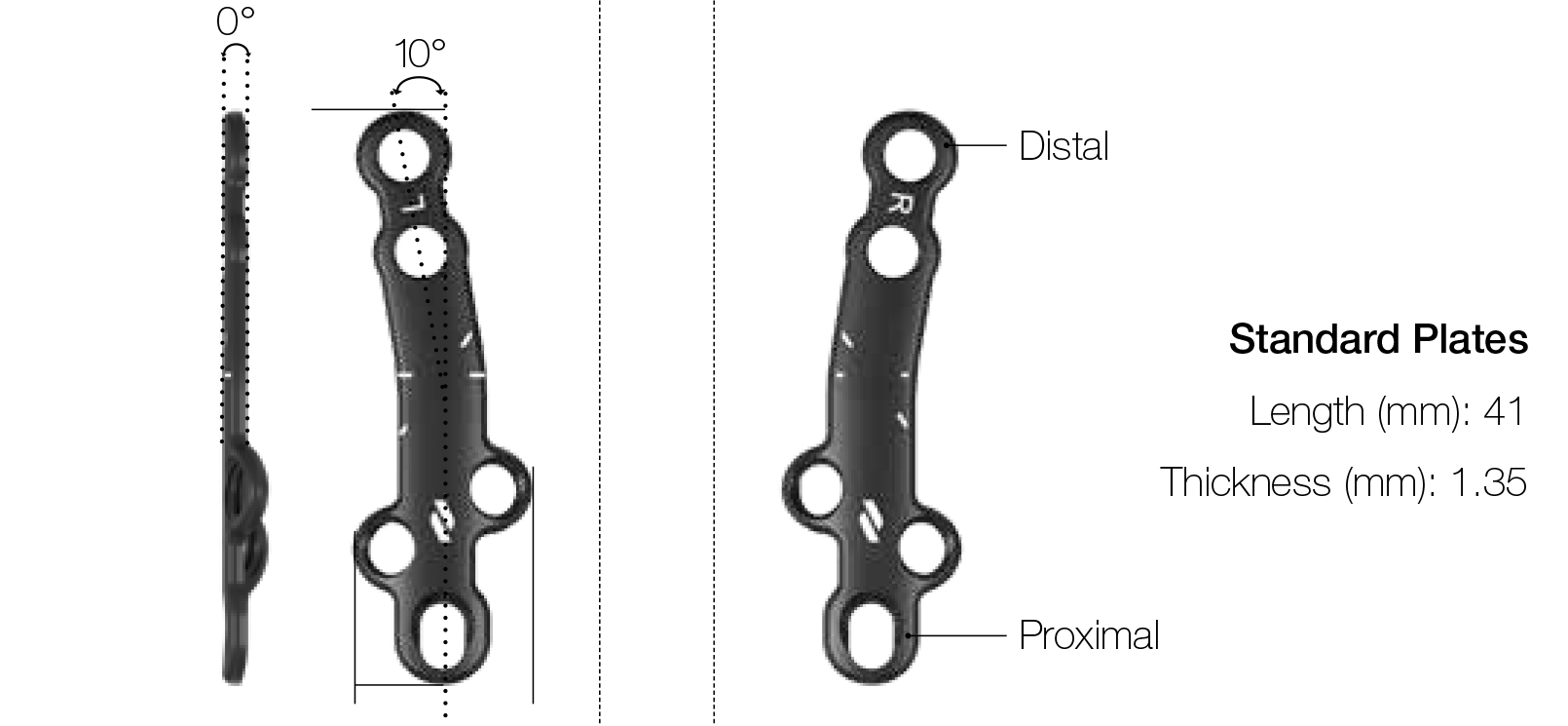 MTP Long / Revision Plates | Novastep