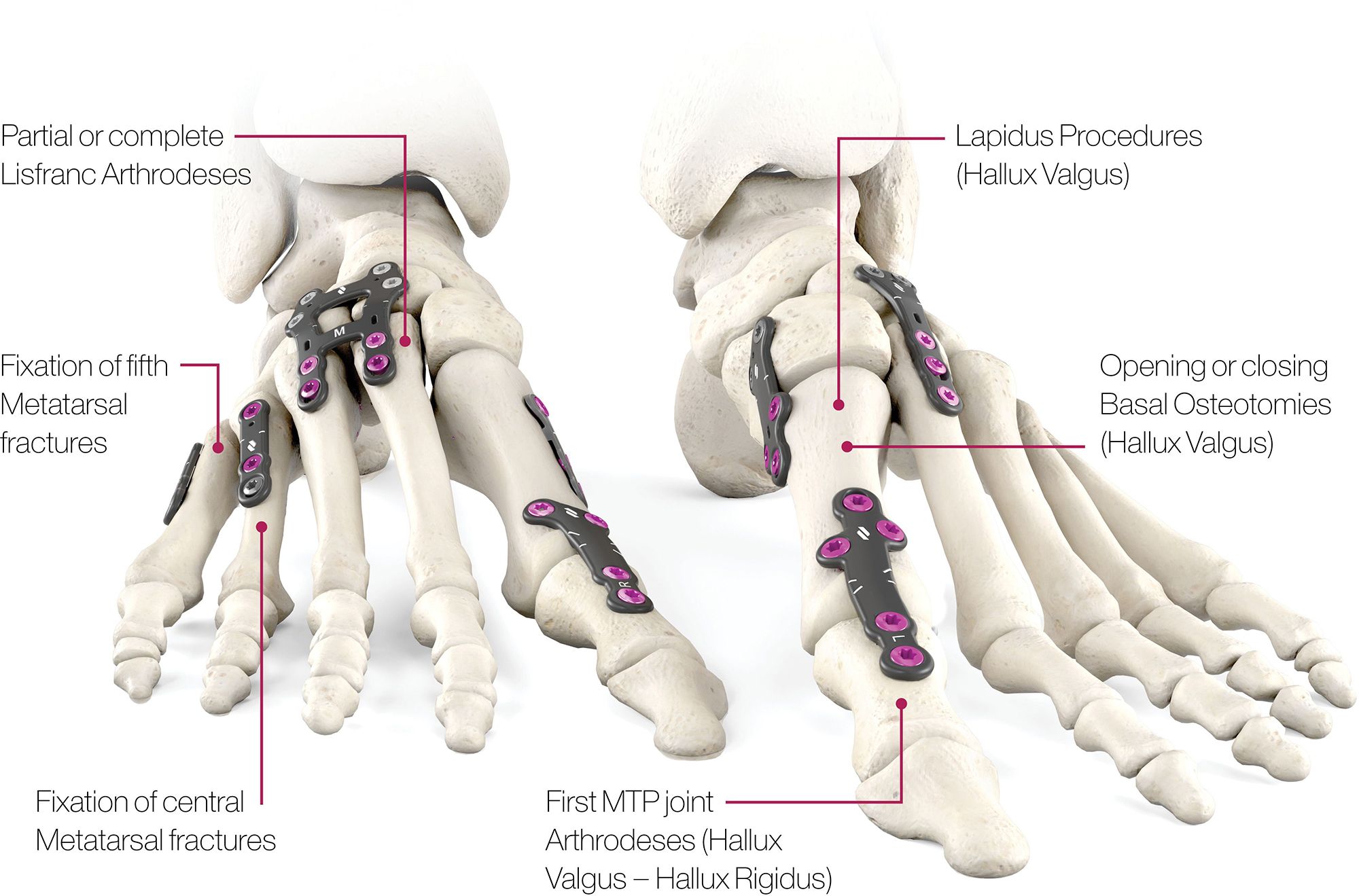 AirlockGo | Novastep