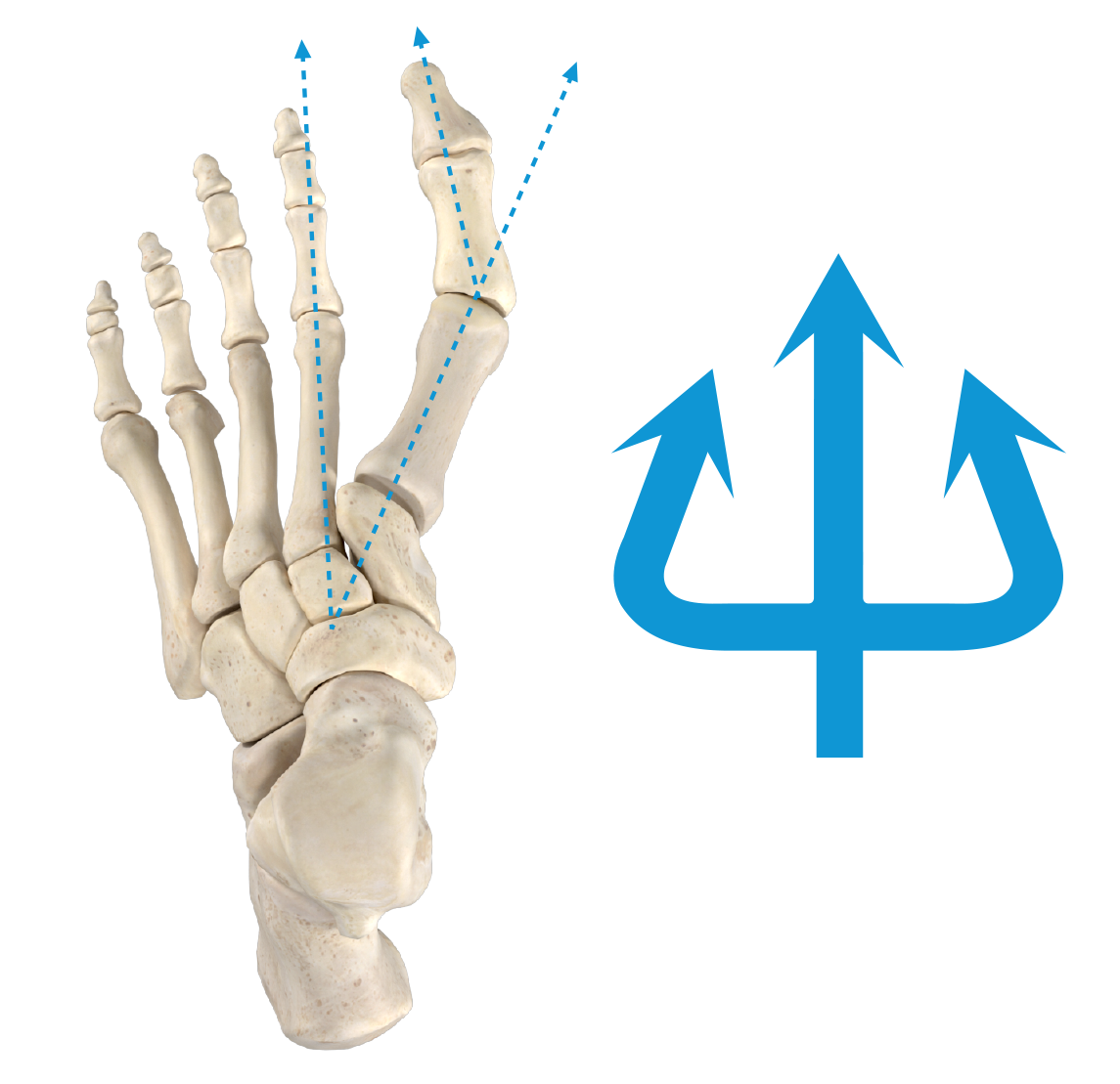 Guided Bunion Instruments | Novastep